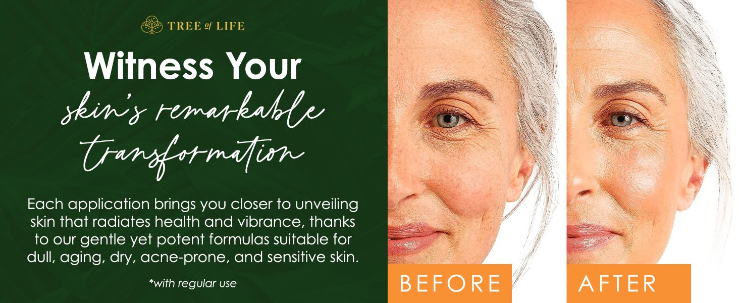 Tree of Life: 3 Essential Serums for Youthful, Radiant Skin - ROMEROSA